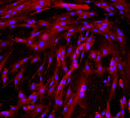 Ma Awarded NSF Manufacturing Grant for Scale-Up of Therapeutic Cell ...